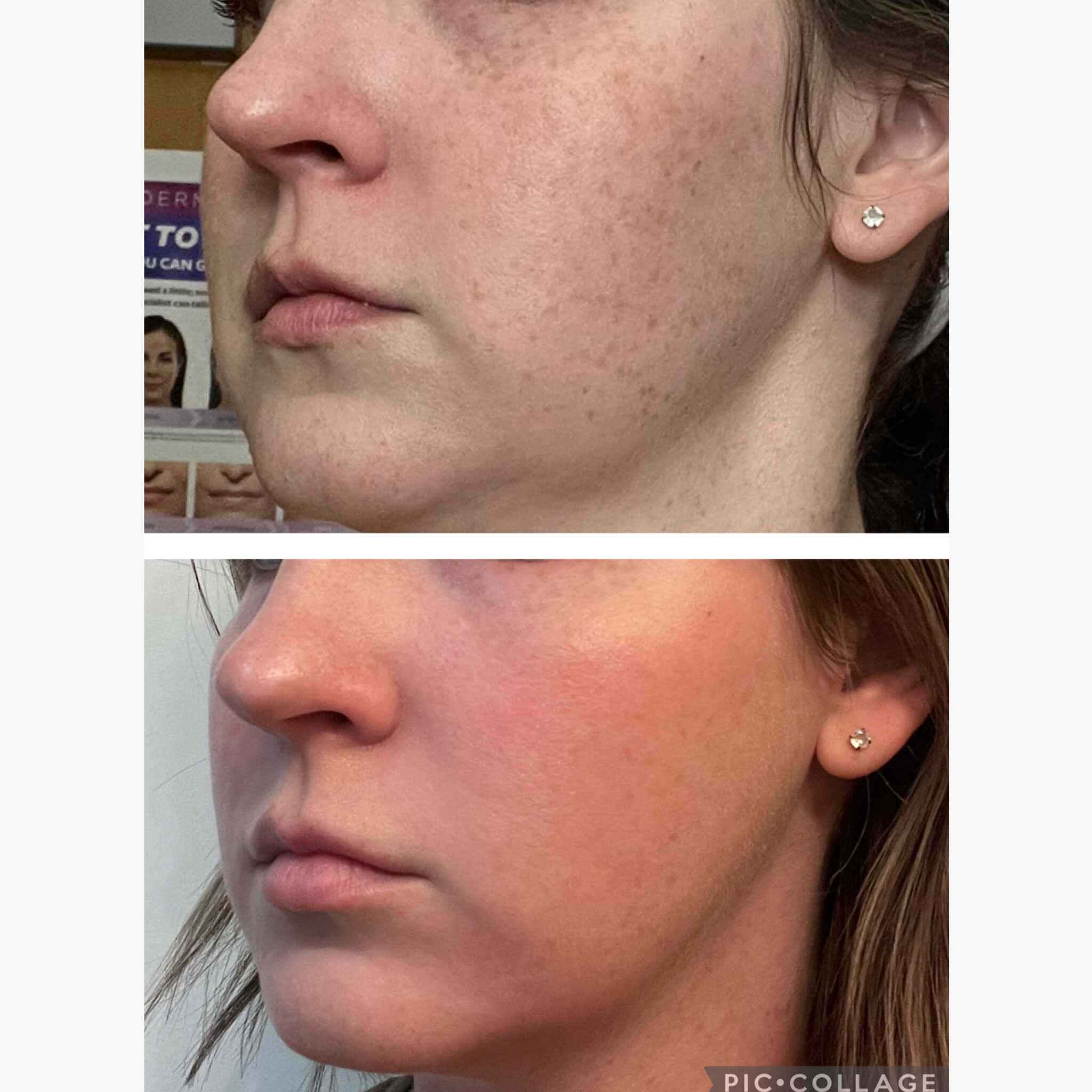 Gallery | Ultra Smooth Skin